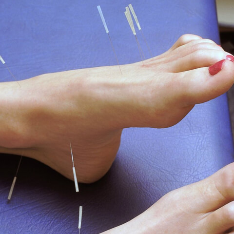 Centre d'Acupuncture Chinoise Ke Zhu | Acupuncture Gatineau